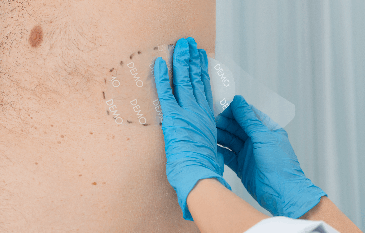 PHN - Designed to be Different | QUTENZA HCP